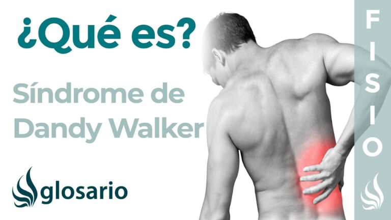¿Qué es el síndrome de Dandy-Walker? Síntomas, causas y tratamiento ...