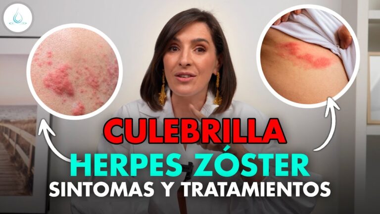 La Mejor Pomada para Herpes en la Piel: Efectividad y Recomendaciones ...